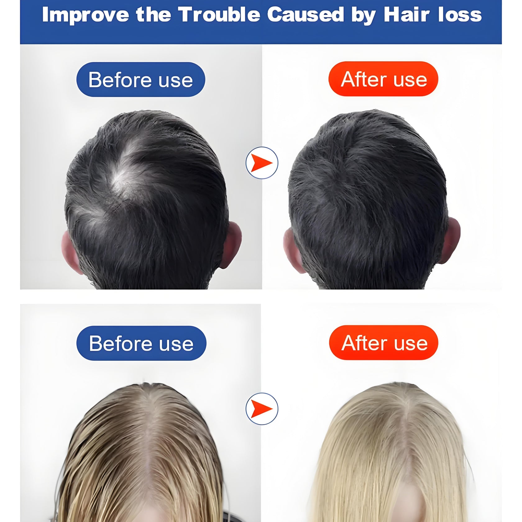 red light therapy cap for hair growth – Astarexin